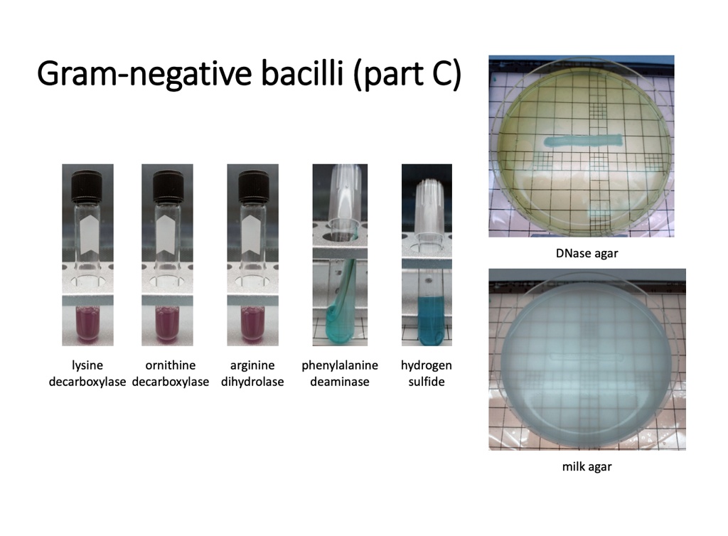 SOLVED: Gram-negative bacilli (part C) DNase agar lysine ornithine ...