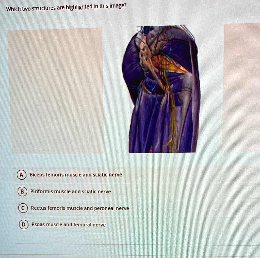 SOLVED: Which two structures are highlighted in this image? Biceps ...