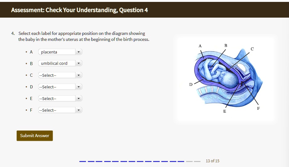 Assessment: Check Your Understanding, Question 4 4. Select each label ...