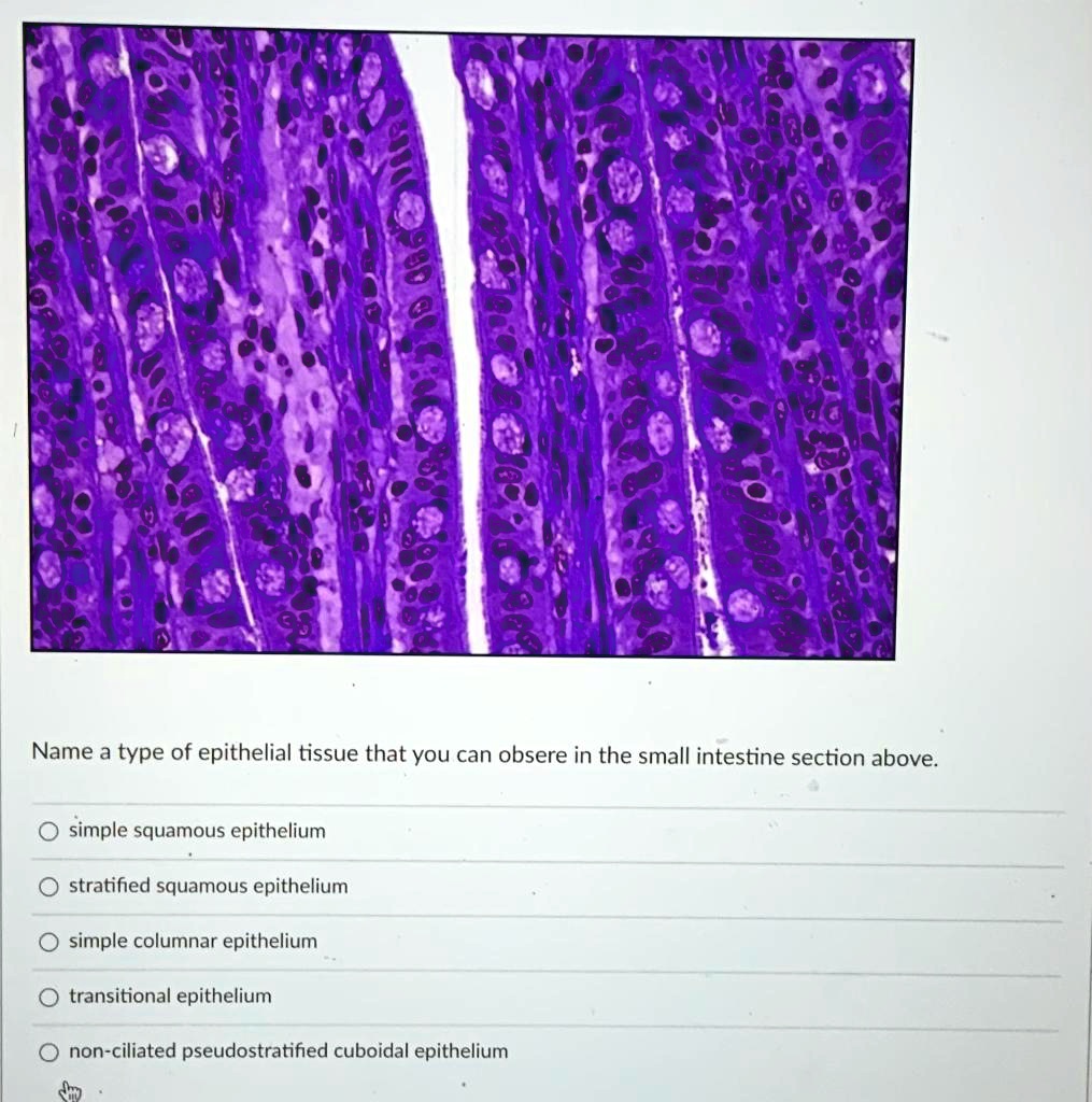 name a type of epithelial tissue that you can observe in the small ...