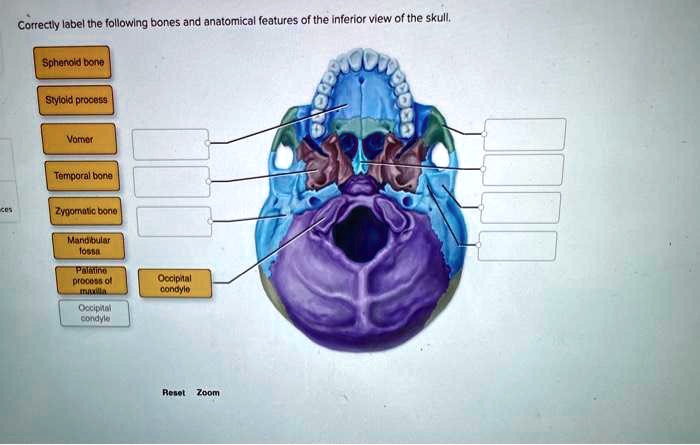Solved Correctly Label The Following Bones And Anatomical Features Of