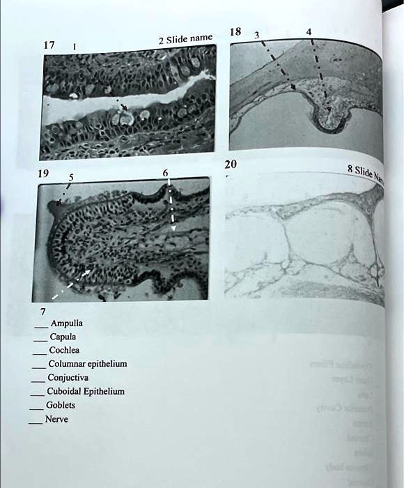 SOLVED: Slide name 17 20 8 Slide N 19 Ampulla Capula Cochlea Columnar ...