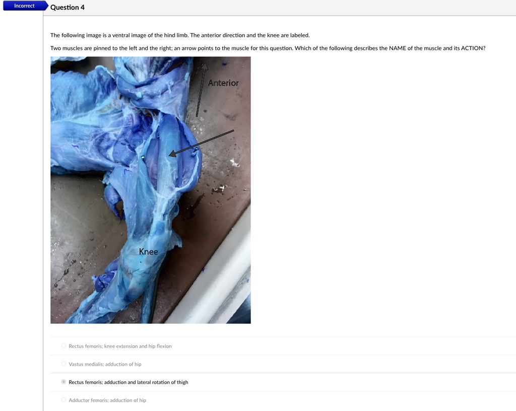 Question 4: The following image is a ventral image of the hind limb ...