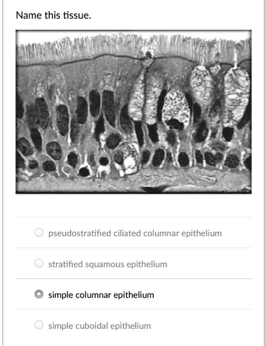 SOLVED: Name this tissue Pseudostratified ciliated columnar epithelium ...