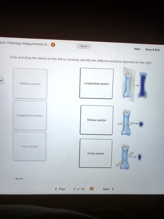 Quiz: Histology Integumentary S... Saved Help Save Exit Click and drag the labels on the left to ...