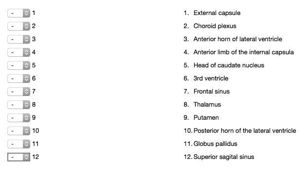 SOLVED: External capsule Choroid plexus Anterior horn of lateral ...