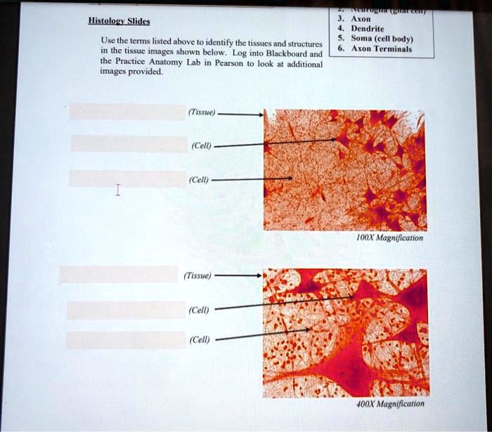 Histology Slides Use the terms listed above to identify the tissues and ...