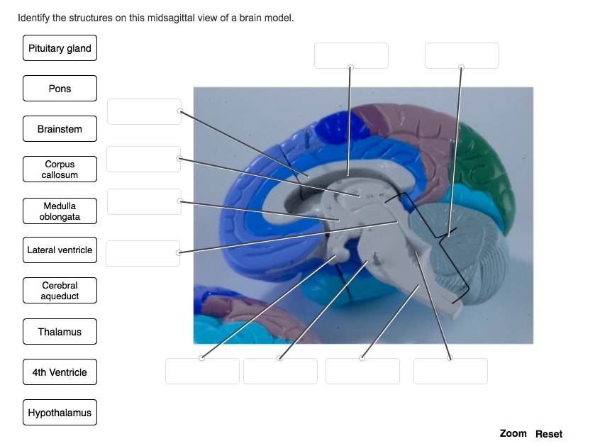 SOLVED: Identify the structures on this midsagittal view of a brain ...