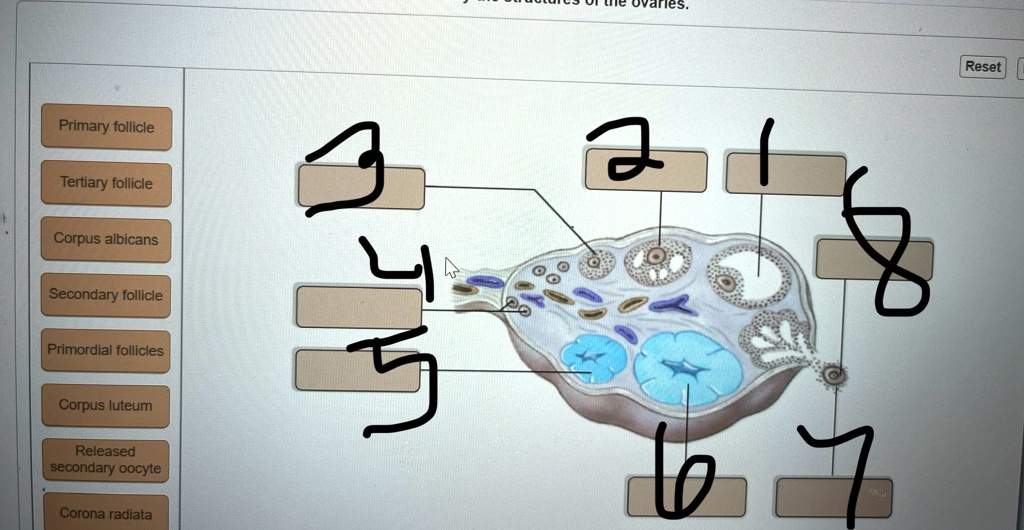 please label 1 8 correctly using word bank l5q6 reset primary follicle ...