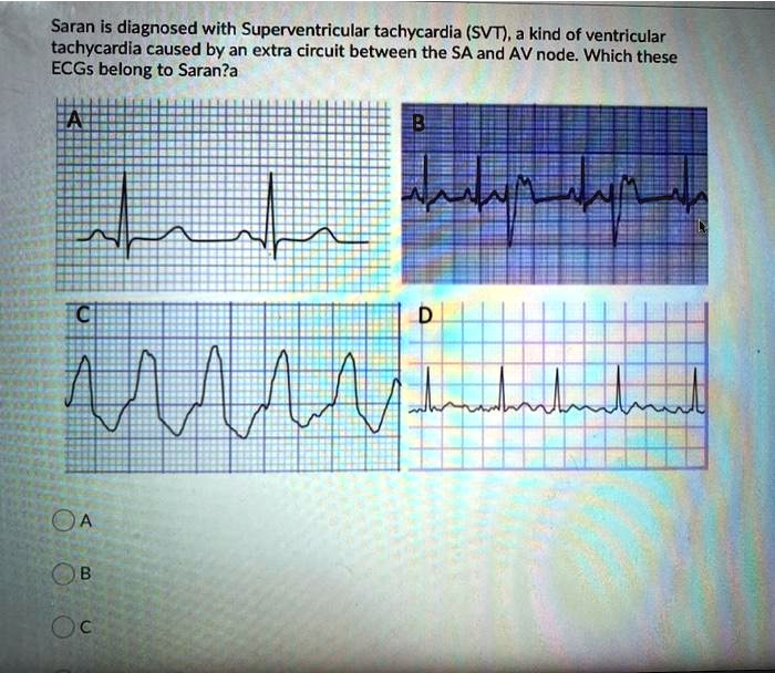 SOLVED: Saran is diagnosed with Supraventricular tachycardia (SVT), a ...