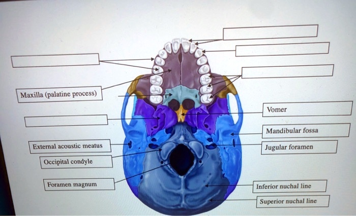 Maxilla (palatine process) External acoustic meatus Occipital condyle ...