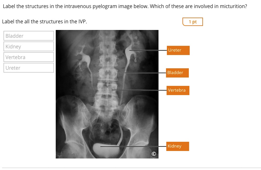 Label the structures in the intravenous pyelogram image below. Which of ...