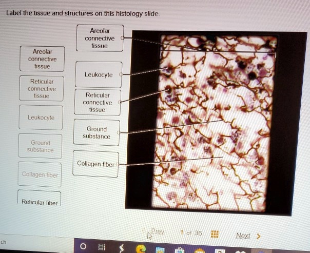 SOLVED: Text: Label the tissue and structures on this histology slide ... SOLVED: Text: Label the tissue and structures on this histology slide ...