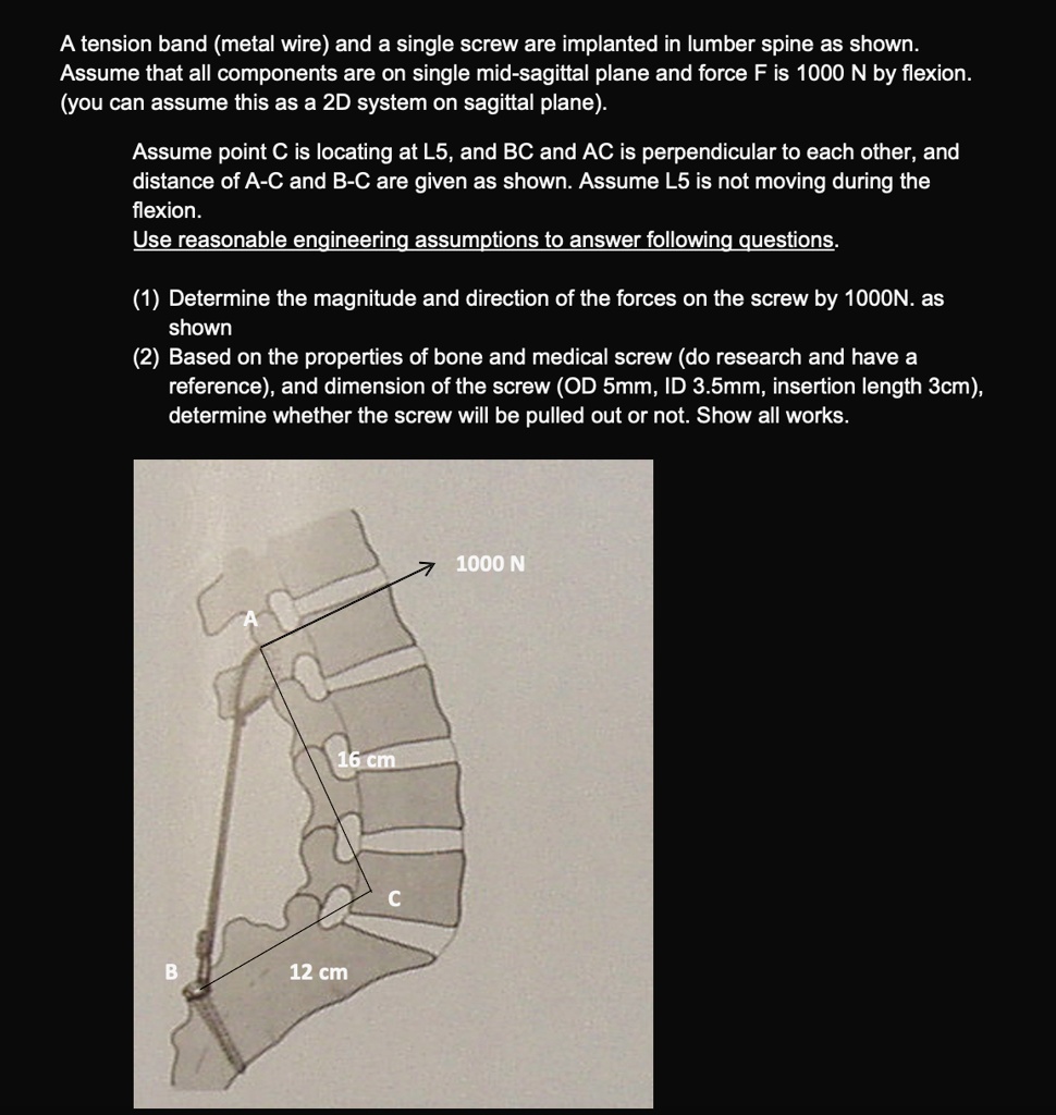 a tension band metal wire and a single screw are implanted in lumber ...