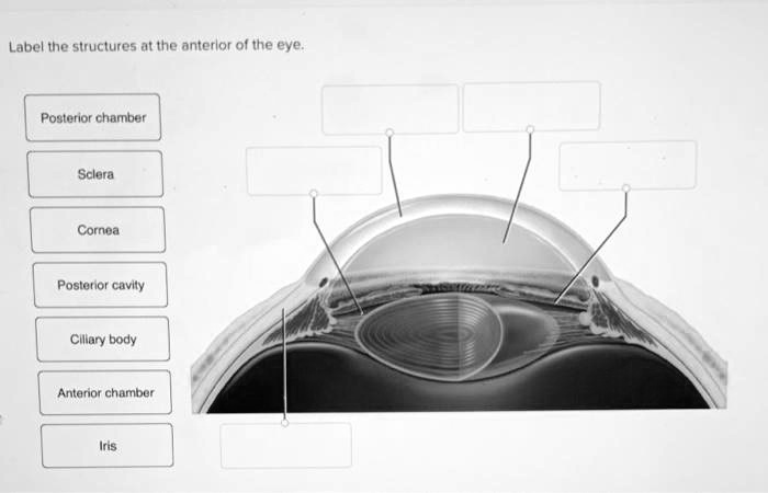 Label the structures at the anterior of the eye: - Posterior chamber ...