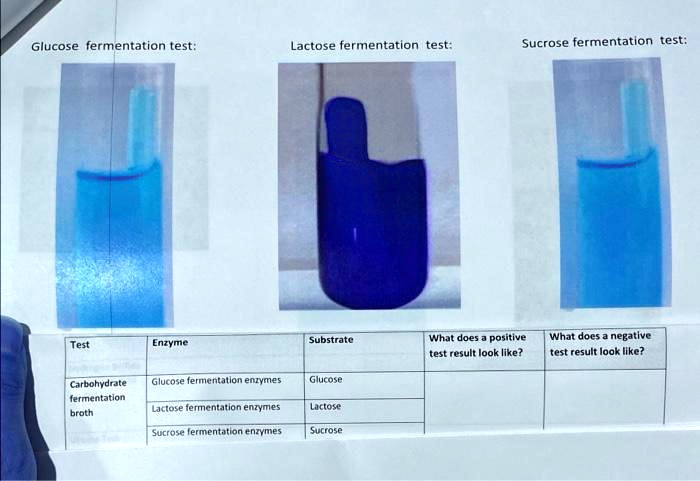 VIDEO solution: Glucose fermentation test: Lactose fermentation test ...