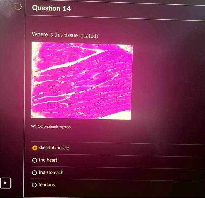 SOLVED: Texts: Question 14 Where is this tissue located? WITCC photomicrograph skeletal muscle ...