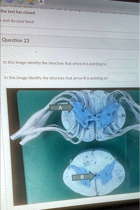 Question 23 In this image identify the structure that arrow A is pointing to In this image ...