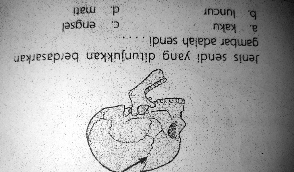 SOLVED: Jenis sendi yang di tunjukan berdasarkan gambar adalah sendi ...