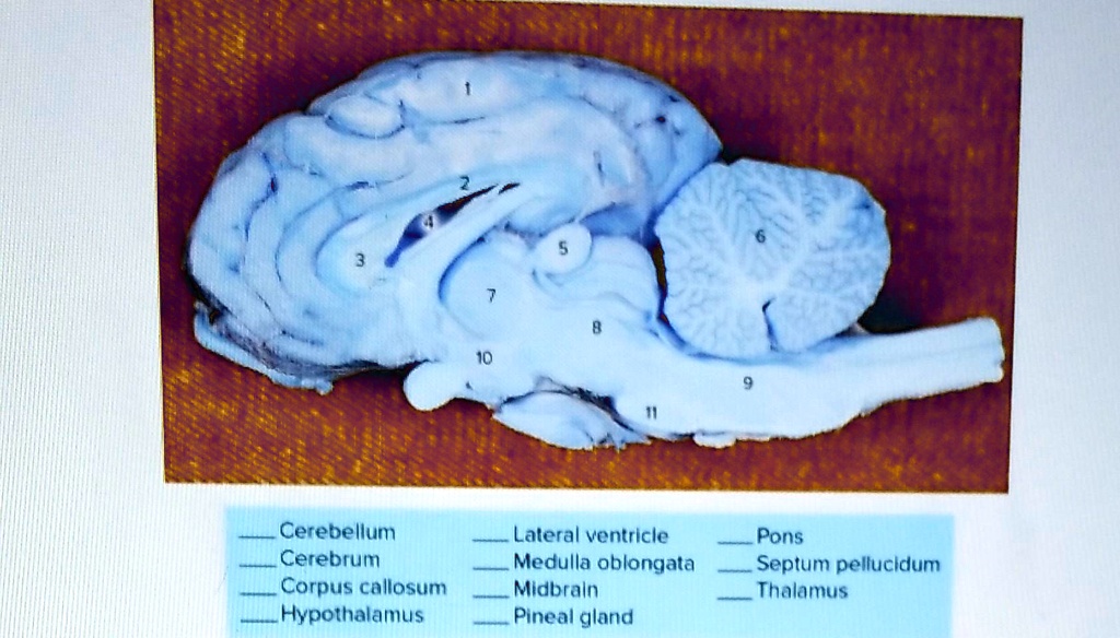 SOLVED: Cerebellum, Cerebrum, Corpus callosum, Hypothalamus, Lateral ...