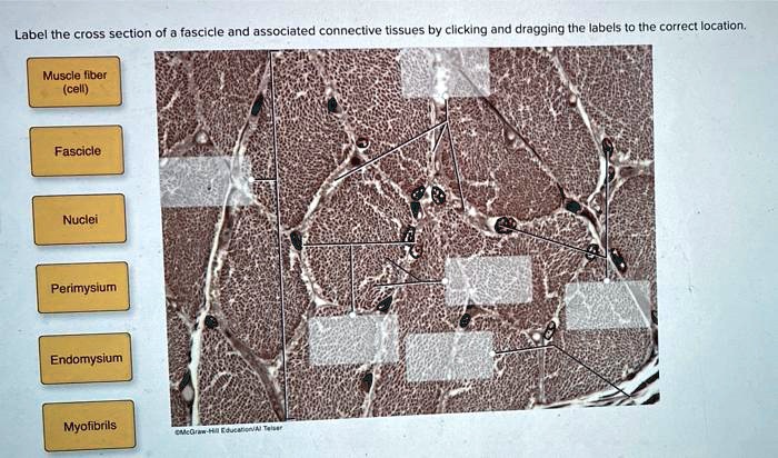 label the cross scction of fascicle and associated connective tissues ...