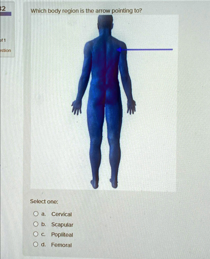 Which body region is the arrow pointing to? Select one: a. Cervical b ...