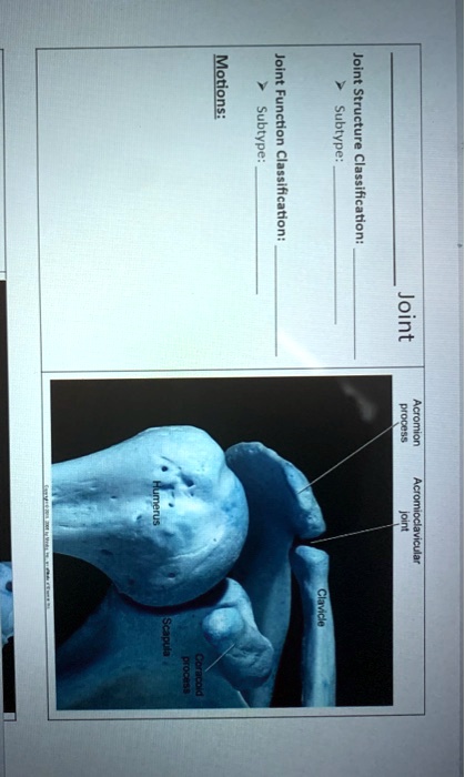 SOLVED: Joint structure classification Motions: Subtype: Joint Function Classification: Subtype ...