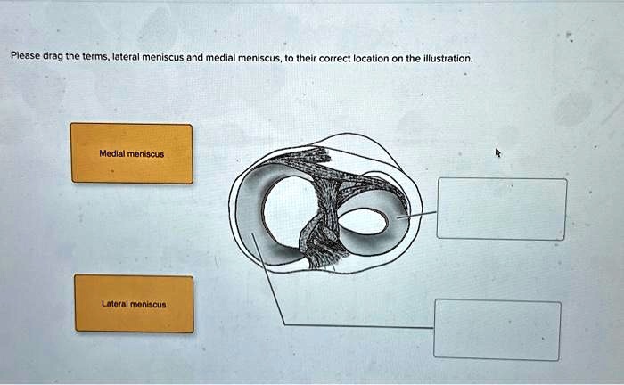 Please drag the terms, lateral meniscus and medial meniscus, to their ...