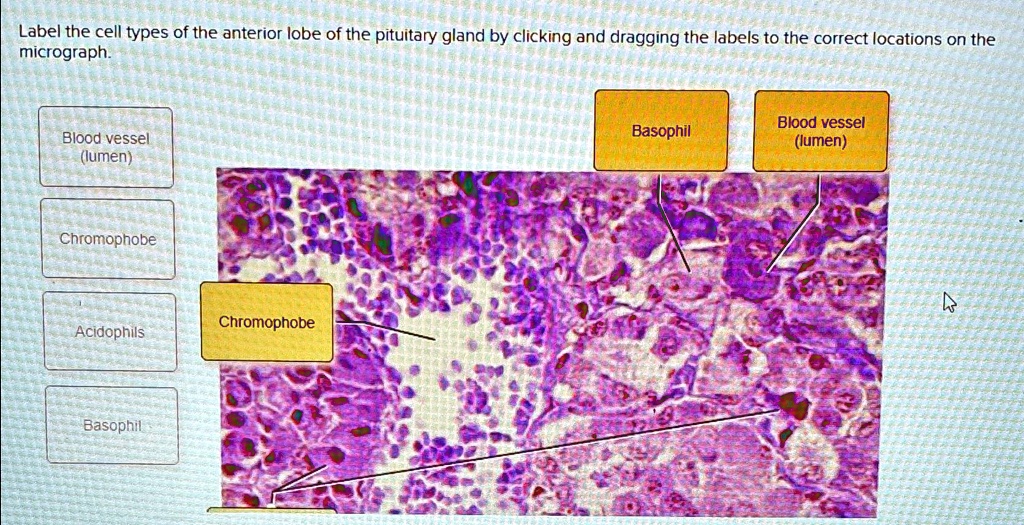 label the cell types of the anterior lobe of the pituitary gland by ...