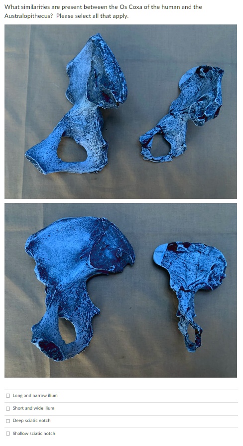 SOLVED: What similarities are present between the Os Coxa of the human ...