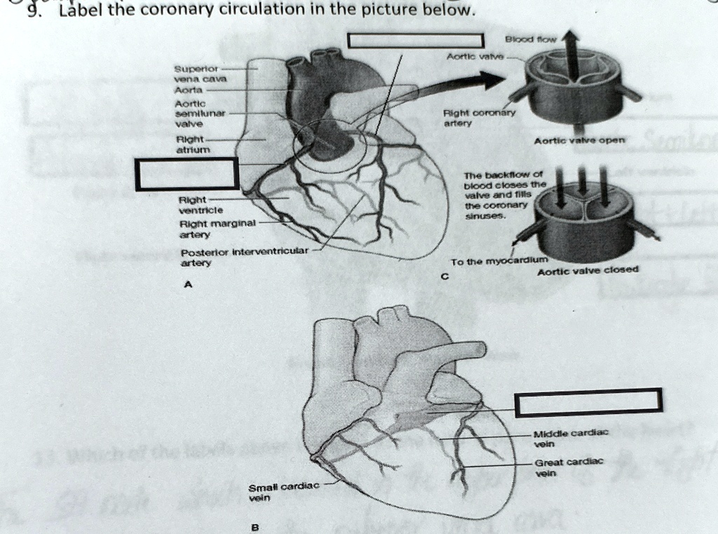 9 label the coronary circulation in the picture below superior vena cava aorta aortic semilunar ...