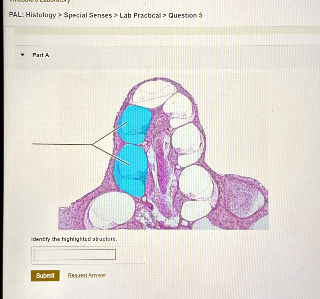 PAL: Histology > Special Senses > Lab Practical > Question 5 ? Part A Identify the highlighted ...