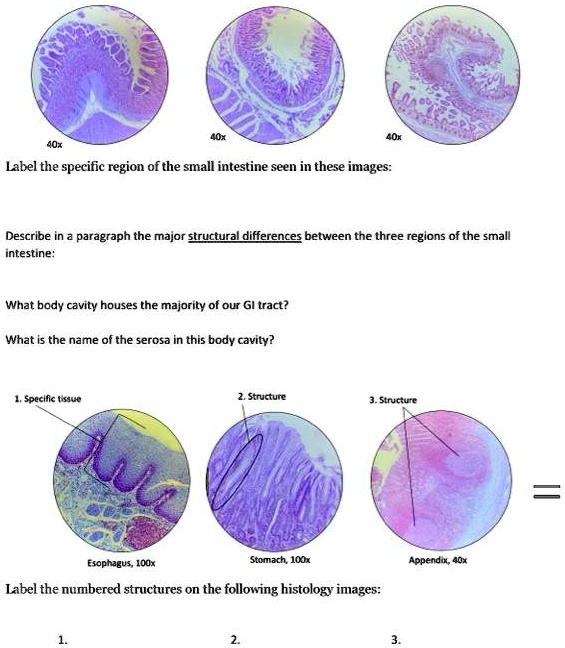 40x 40x 40x Label the specific region of the small intestine seen in ...