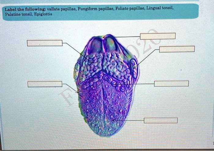 Label the following: vallate papillae, Fungiform papillae; Foliate ...