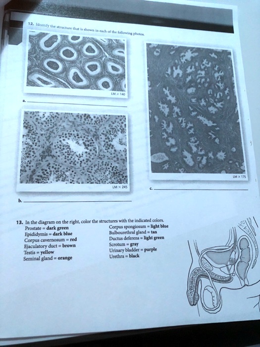 SOLVED: In the diagram on the right, color the structures with the ...