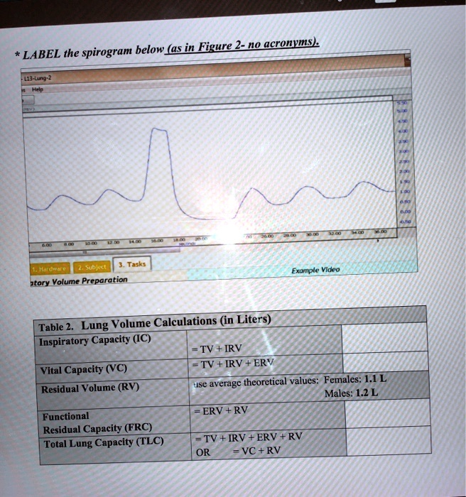 The text below (shown in Figure 2) is a spirogram label. Ly-Ln = East ...