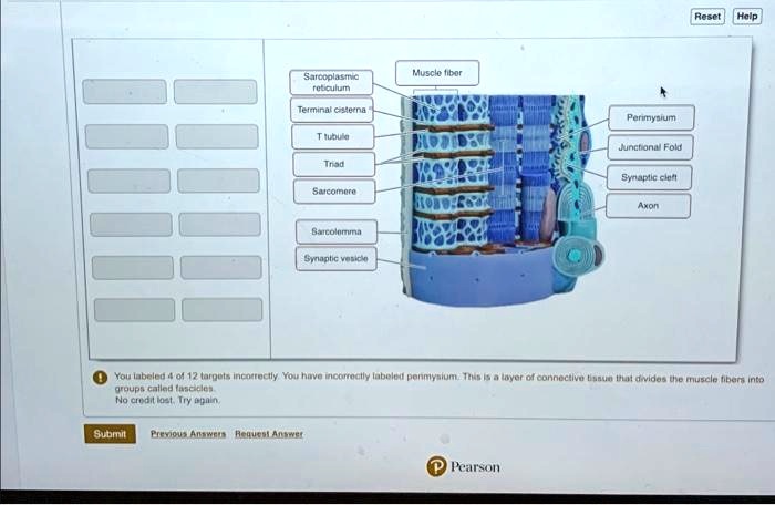 Sarcoplasmic reticulum Terminal cisterna T tubule Triad Sarcomere ...