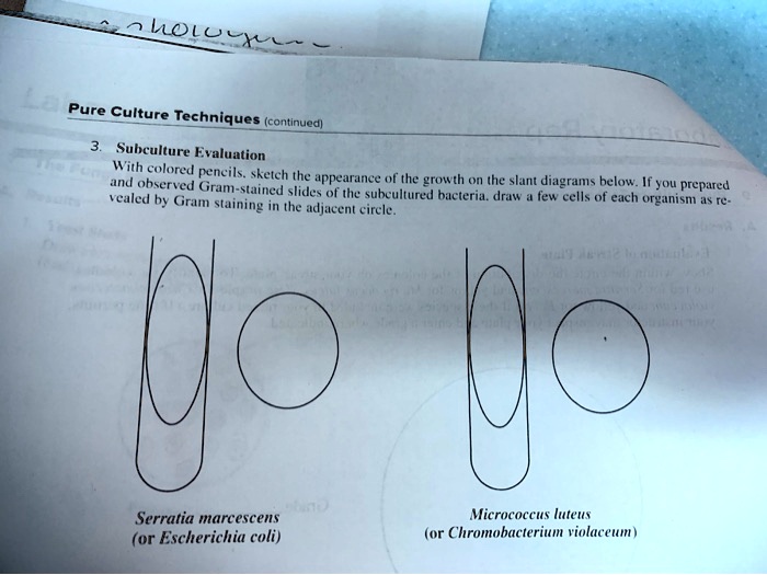 SOLVED: Pure Culture Techniques (continued) Subculture Evaluation and ...