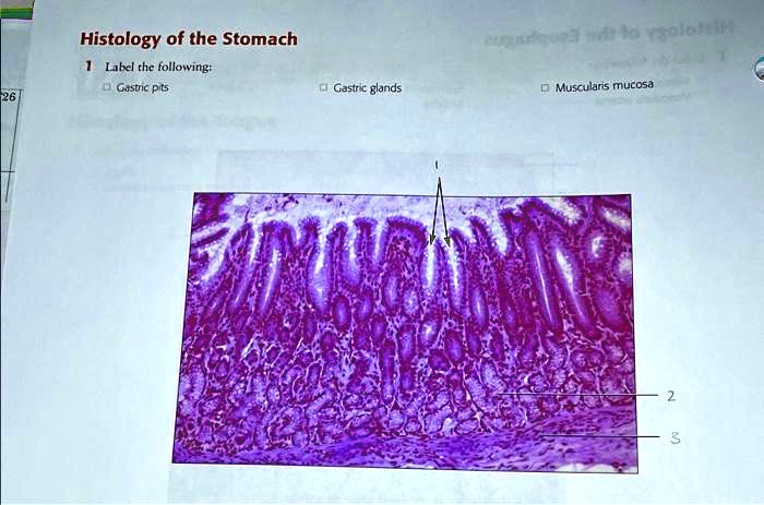 SOLVED: label the following Histology of the Stomach 1Label the ...