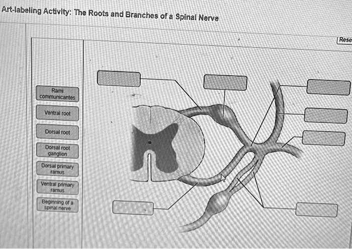 Art-labeling Activity: The Roots and Branches of a Spinal Nerve Rami ...