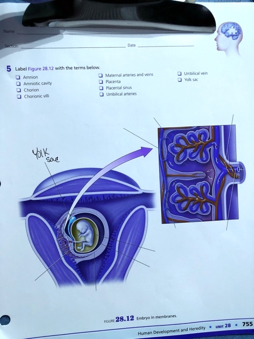 SOLVED: Label Figure 28.12 with the terms below: - Amnion - Maternal ...