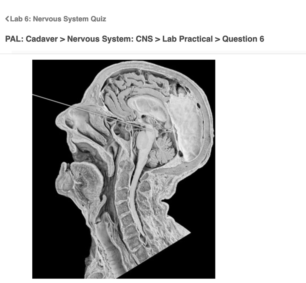SOLVED: Nervous System: CNS > Lab Practical > Question 6 SOLVED: Nervous System: CNS > Lab Practical > Question 6