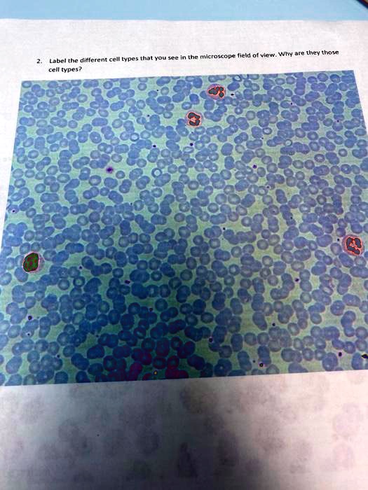 2. Label the different cell types that you see in the microscope field ...