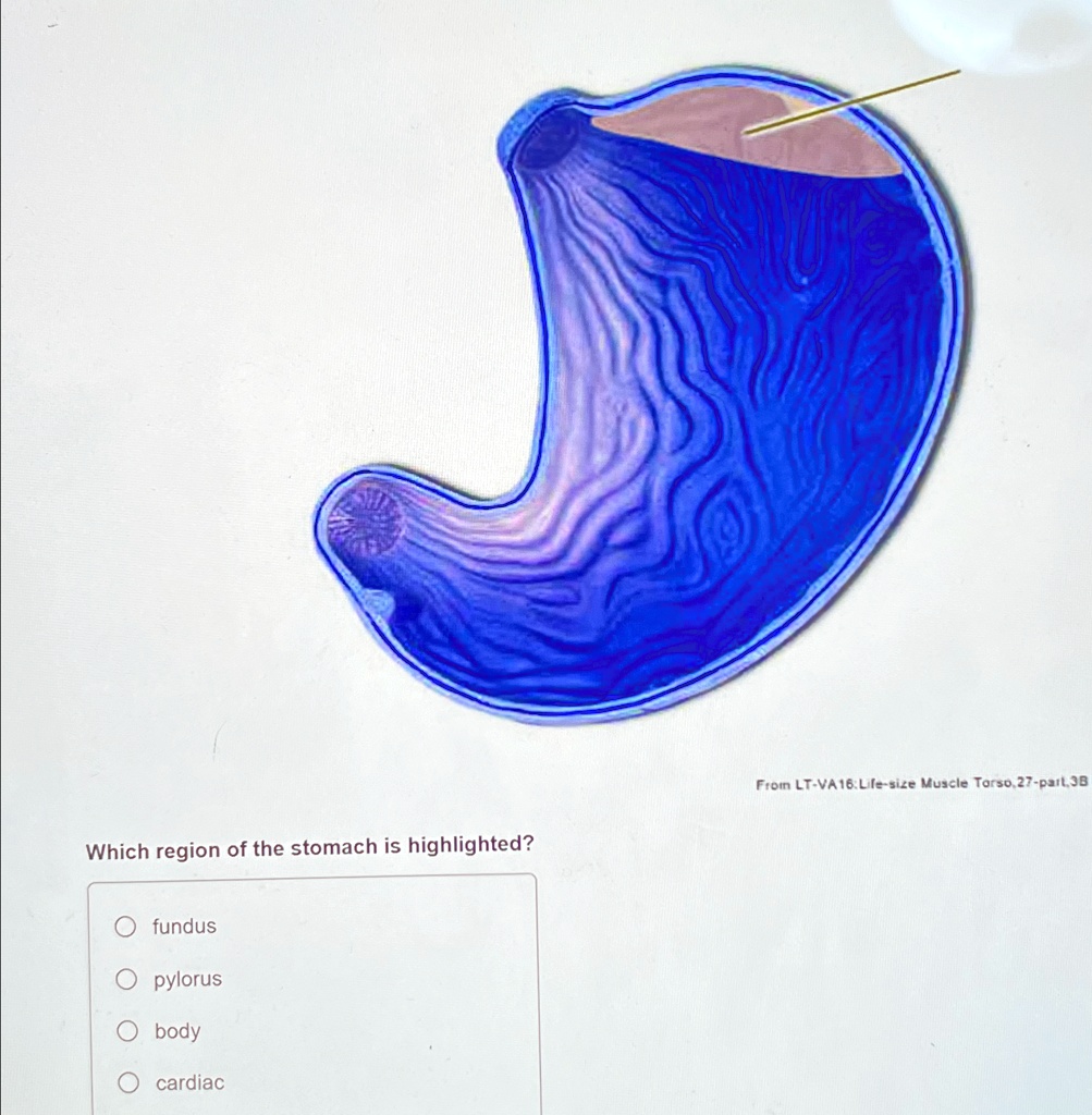 Which region of the stomach is highlighted? fundus pylorus body cardiac ...
