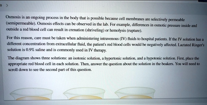 Osmosis is an ongoing process in the body that is possible because cell ...