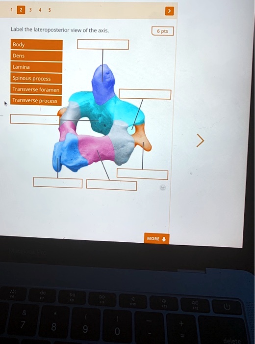 SOLVED: Label the lateroposterior view of the axis. 6 pts Body Dens ...