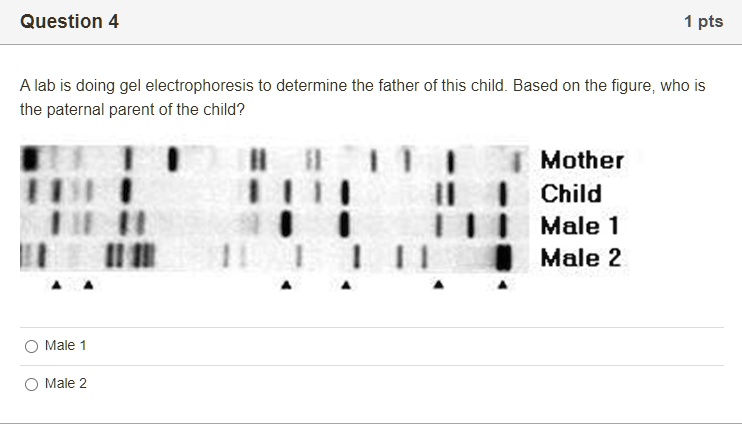 Question 4 1 pts A lab is doing gel electrophoresis to determine the ...