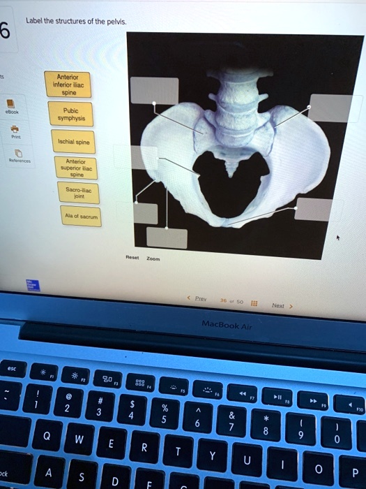 SOLVED: Label the structures of the pelvis. Anterior inferior iliac ...
