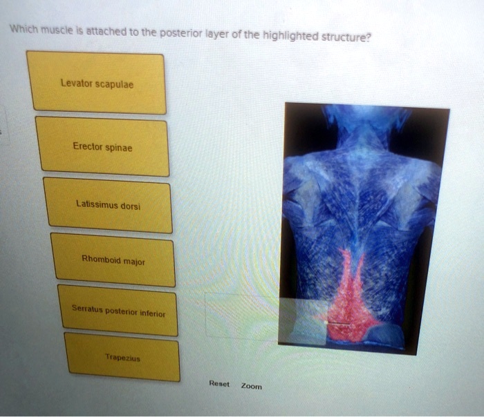 SOLVED: Which muscle is attached to the posterior layer of the ...