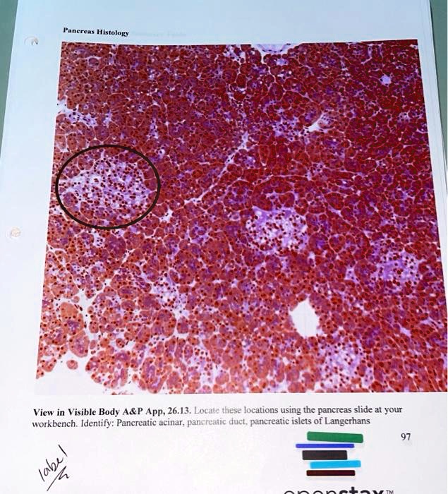 Pancreas Histology View in Visible Body A P App, 26.13. Locate these ...